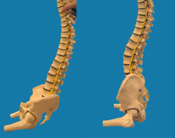 Butt-grippers, Back-grippers and Chest Grippers - Diane Lee ...